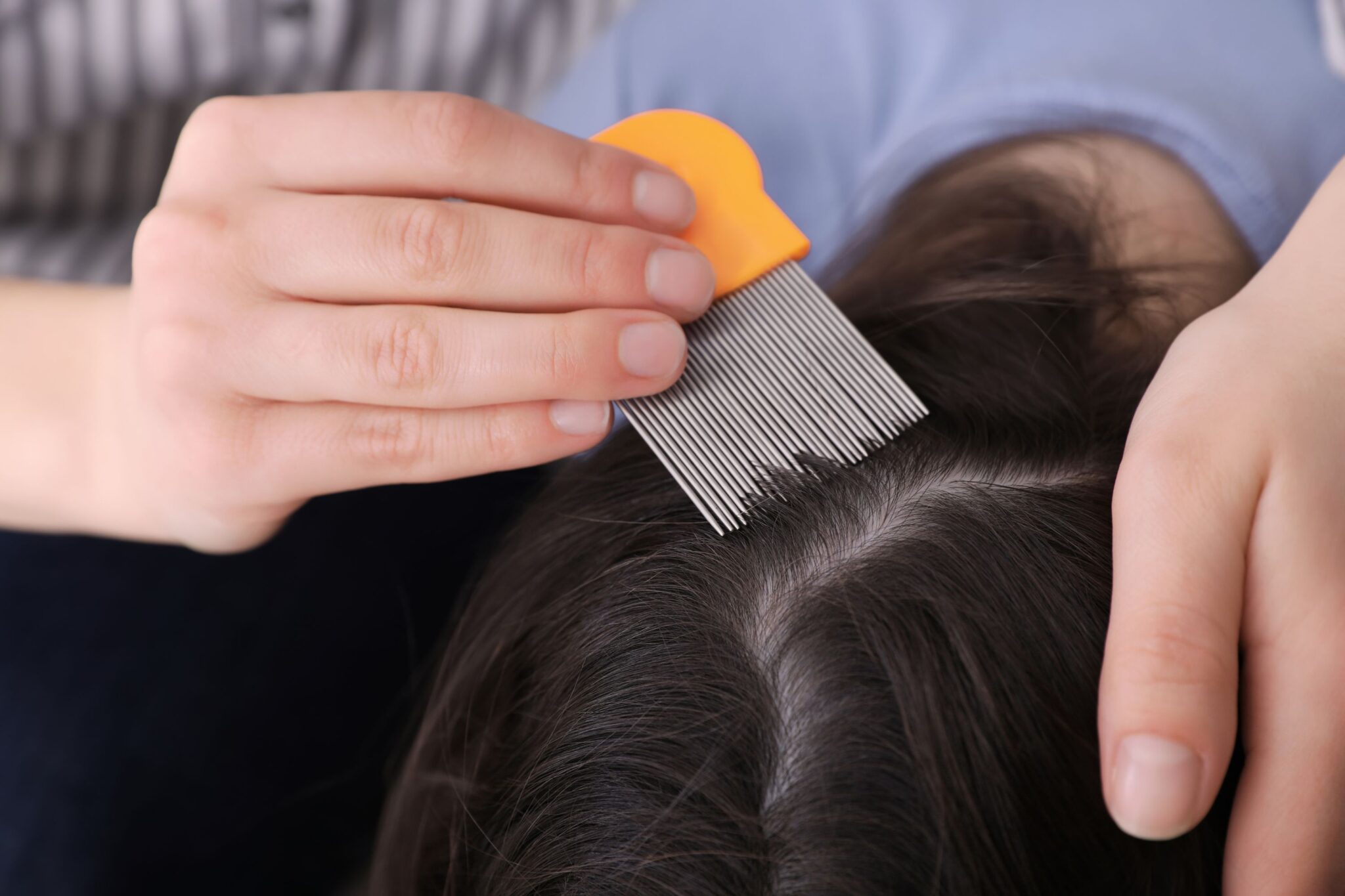 Super Lice: What They Are and How to Get Rid of Them for Good - Good Riddance Lice Clinic
